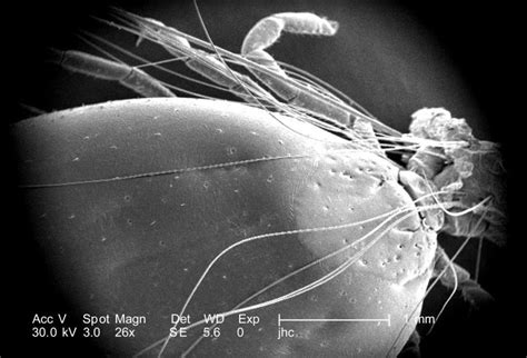 무료 사진 부풀어 오른 여성 틱
