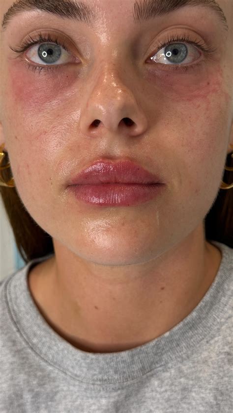 Facial Balancing Sydney