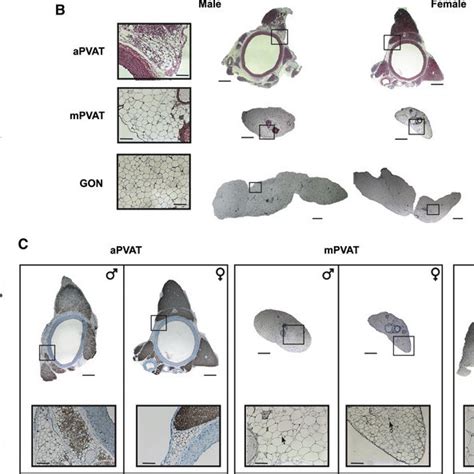 Perivascular Adipose Tissue Pvat Adipocyte Phenotype Varies Depending