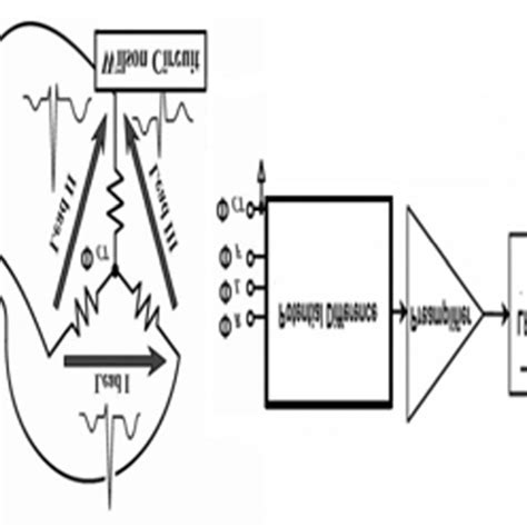 A Typical Ecg Signal Detection System Download Scientific Diagram