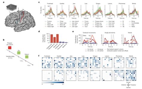 Researchers At Ucsf And Uc Berkeley Have Developed A Brain Computer Interface Bci That Has