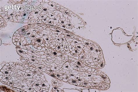 Education Of Grasshopper Testis Under The Microscope In Lab 1179973871 게티이미지뱅크