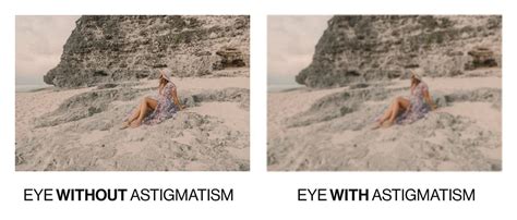 Astigmatism What It Is Causes And Operation Oftalvist