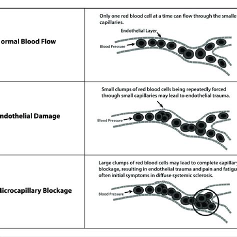 Potential Impact Of Rbc Aggregation On Endothelial Integrity Download Scientific Diagram