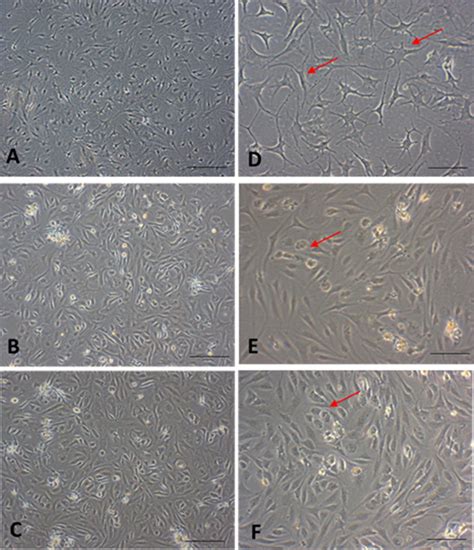 Human Oa Articular Chondrocytes In Monolayer Culture Photomicrographs Download Scientific