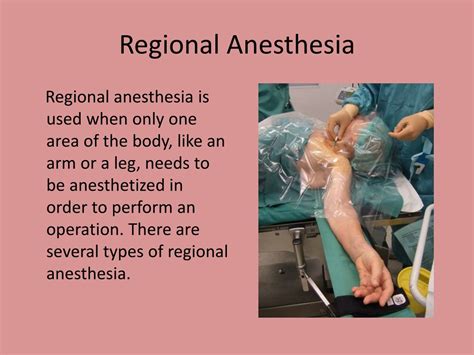 Ppt Types Of Anesthesia Powerpoint Presentation Free Download Id