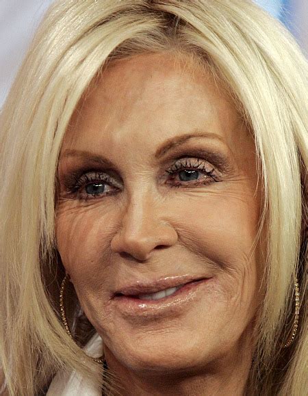 Joan Van Ark Plastic Surgery
