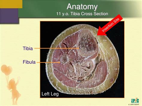 Ppt Hypoperfusion And Shock Powerpoint Presentation Free Download Id3964068