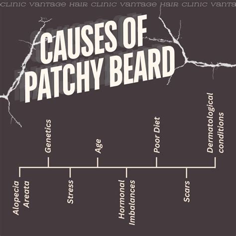 Top 5 Way To Fix Patchy Beard Vantage Hair Clinic