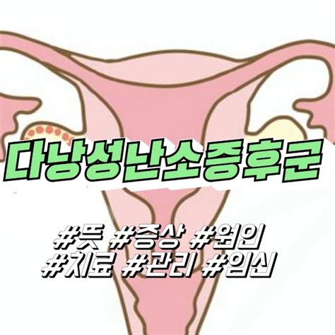 다낭성난소 증후군 증상 뜻 원인 치료 임신 네이버 블로그