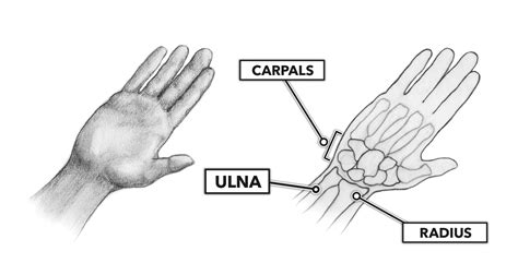 Wrist Abduction And Adduction