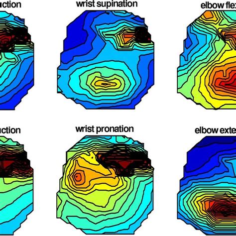 Example Of The Segmentation Process Of The Surface Emg Signals For Download Scientific Diagram