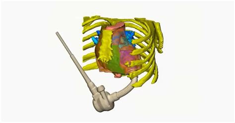 Webinar Modeling And Simulation In Cardiovascular Engineering