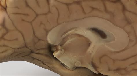 3d Model Human Brain 01 Turbosquid 2144088