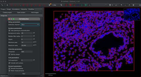 Cell Detection Parameters What Are Each Of The Settings And
