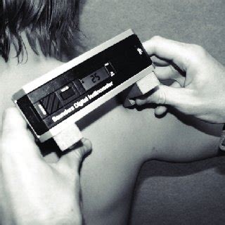 Scapular Upward Rotation Measurement Technique Download Scientific Diagram