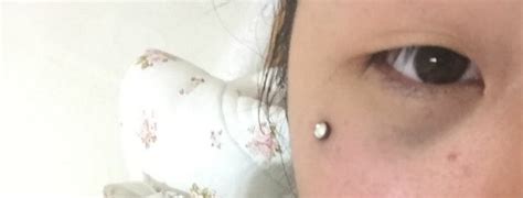 Like529피어싱 마이크로더멀 일명 눈물피어싱 시술 후기 네이버 블로그