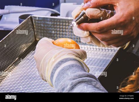 A Woman Trains Using A Frequency Modulated Ultrasound Bone Surgery Machine To Preserve Soft