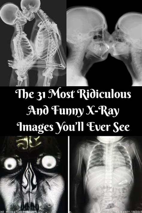 Weld X Ray Memes