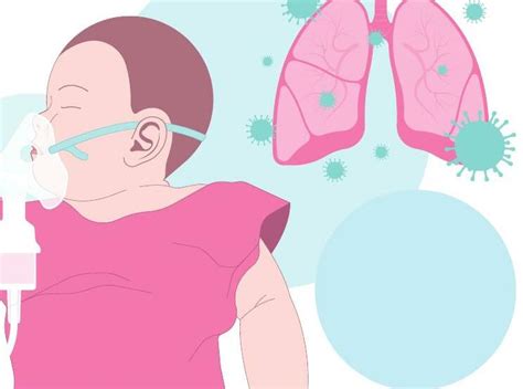 Infant Lung Health Driving Innovations In Ventilator Systems Healthcare Radius Business