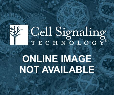 Ripa Buffer 10x Cell Signaling Technology