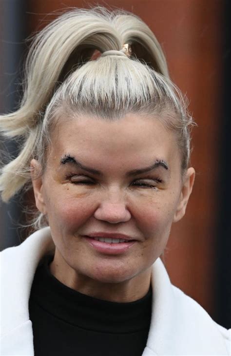 Jaw Dropping Photos Of Atomic Kitten Star Kerry Katona Post Eyelift Nt News