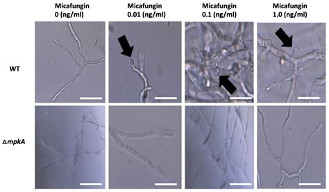 Jof Free Full Text Micafungin Induced Cell Wall Damage Stimulates