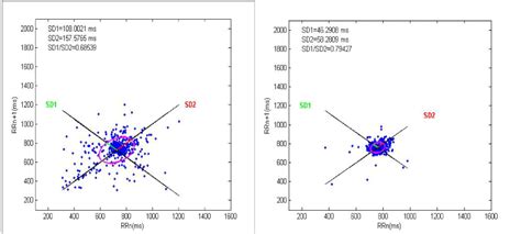 Nonlinear Analysis Of Heart Rate Variability In Type 2 Diabetic Patients