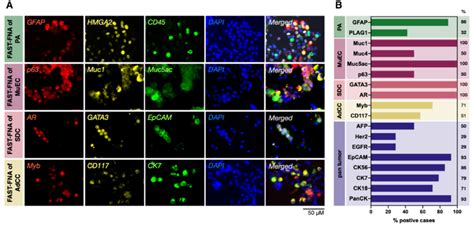 Representative Examples Of Fast Fine Needle Aspiration Fna Analysis