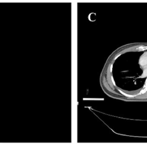 Ct Images And Corresponding Labels A Ct Images With Gtv Red Contour Download Scientific