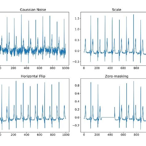 Different Augmentations Applied On A Sample Ecg Segment Download Scientific Diagram