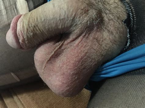 Lonely Girl Night 5 Pics Xhamster