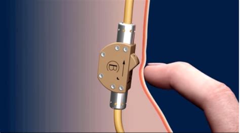 New Male Birth Control Sperm Switch Temporaily Sterilizes Men With The Flip Of A Switch