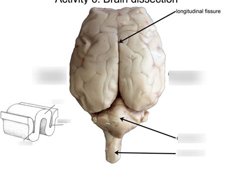 Brain Dissection Diagram Quizlet