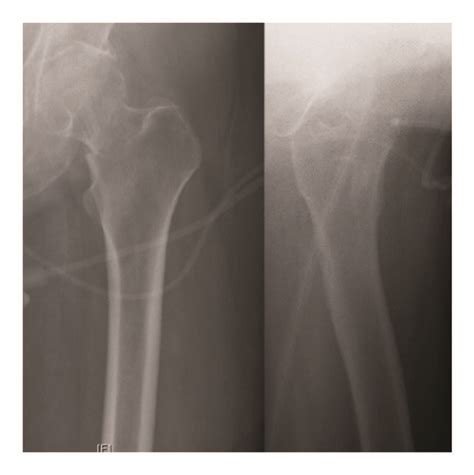 A A 61 Year Old Female Sustained A Syncopal Fall At Home Resulting In Download Scientific