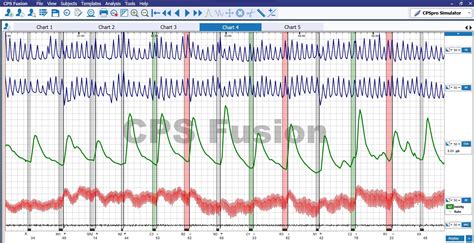 Lie Detector Test Chart