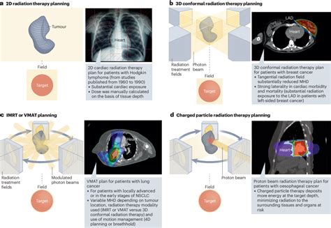 Ionizing Radiation Examples In Medicine And Nature