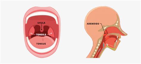 Tonsils And Adenoids Diagram