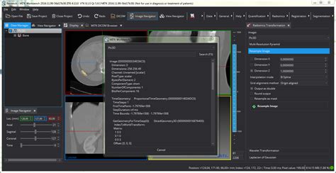 Medical Imaging Interaction Toolkit Gui Based Radiomics Tutorial