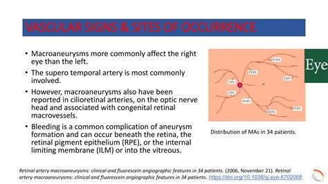 Retinal Artery Macroaneurysm Pptx