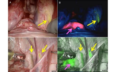 Multispectral Imaging Of Fluorescein And Icg In Vivo With The Firefly