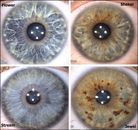 The 4 Main Types Of Iris Patterns You Should Know With Images