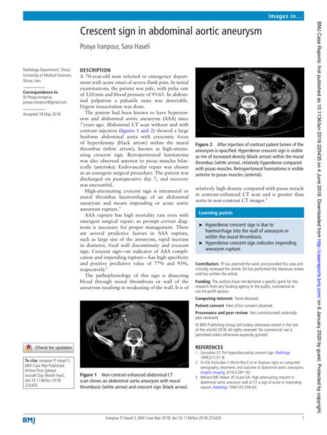 Pdf Crescent Sign In Abdominal Aortic Aneurysm