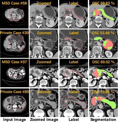 Figure 1 From Generalizable Pancreas Segmentation Via A Dual Self Supervised Learning Framework