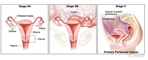 Peritoneal Cavity Female Reproductive System