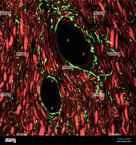 Brain Blood Vessels Confocal Light Micrograph Of A Transverse Section