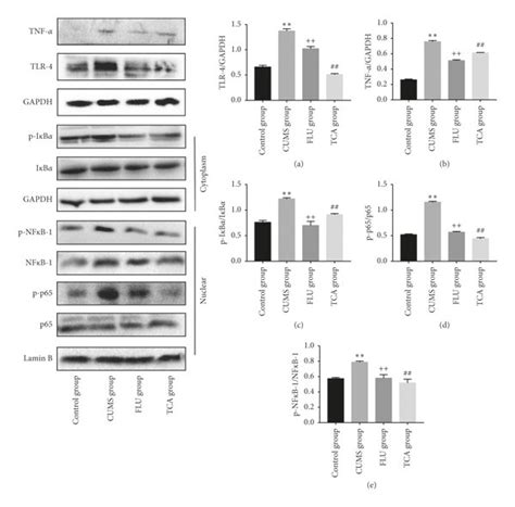 The effect of TCA on NF κB pathway of hippocampus at protein level The Download Scientific