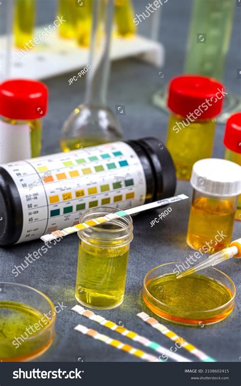 3 123 Urine Cells Images Stock Photos Vectors Shutterstock