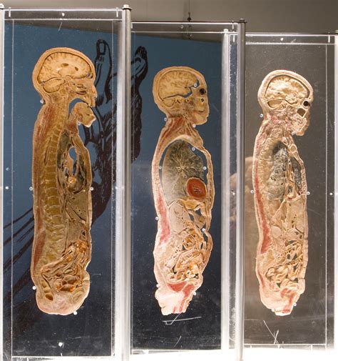 Bodies Revealed Returns To Science Center Life