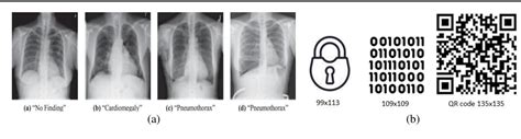 figure 1 from joint watermarking encryption compression algorithm for securing an e healthcare